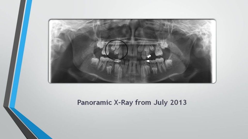 The importance of Panoramic X-Rays - McSurdy Orthodontics