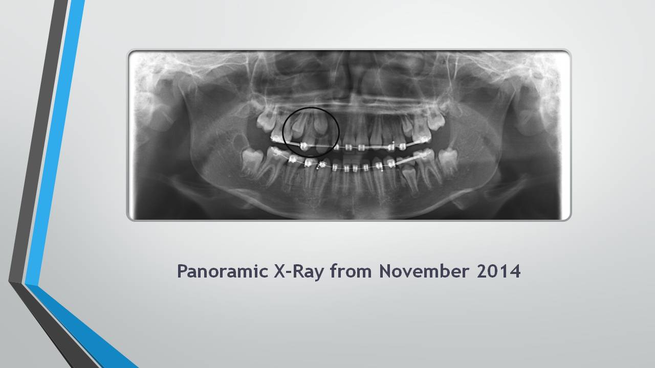 The importance of Panoramic X-Rays - McSurdy Orthodontics